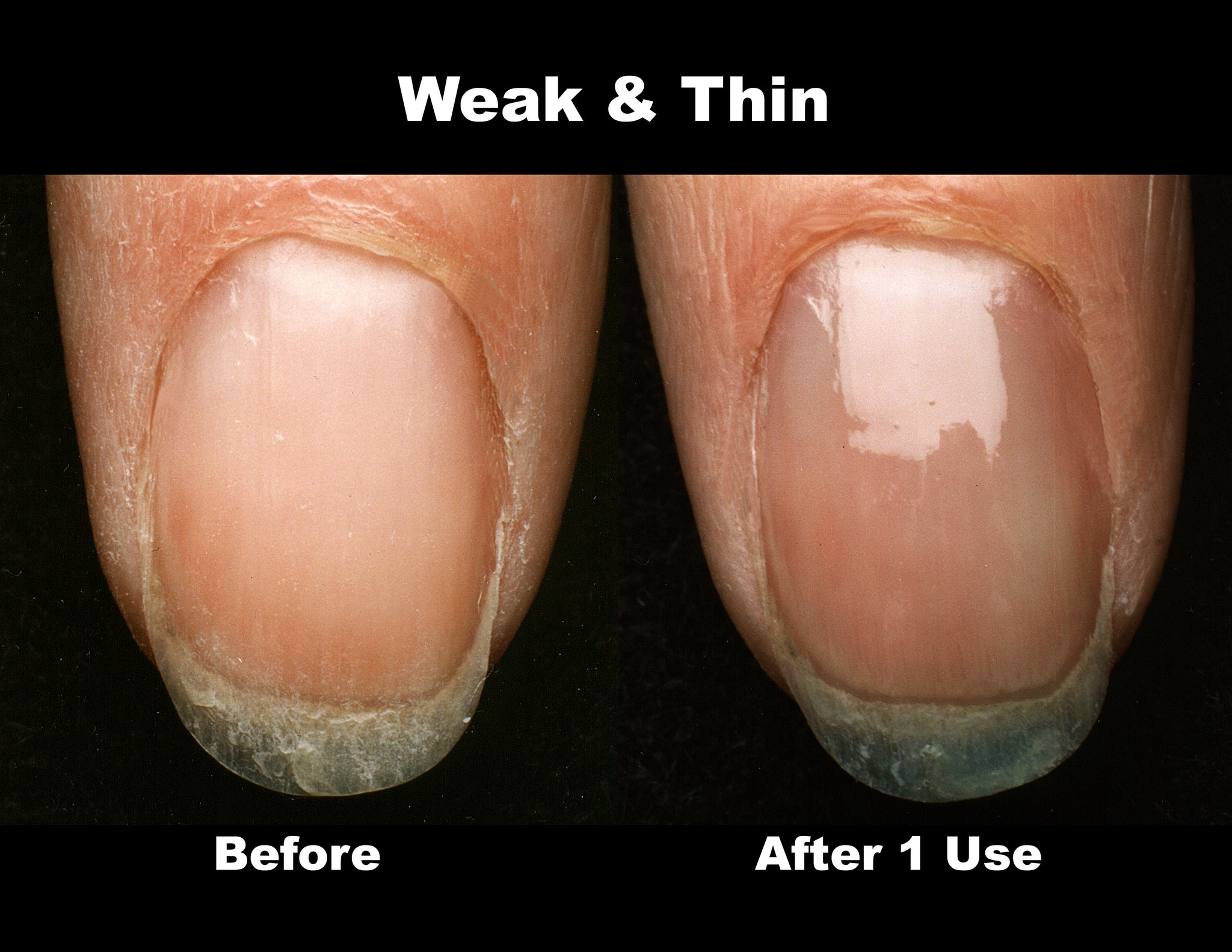 ProStrong ProShield Instant Thickening Top Coat with Fluoride
